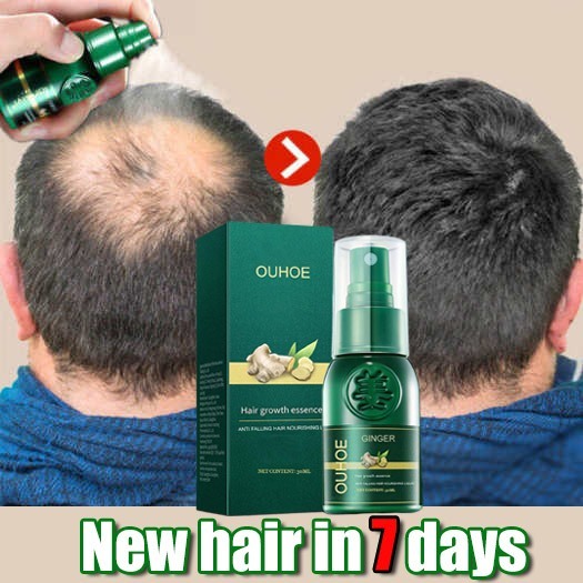 Hair Growth Spray Serum Hair tonic Anti-hair loss spray Hair treatment ...