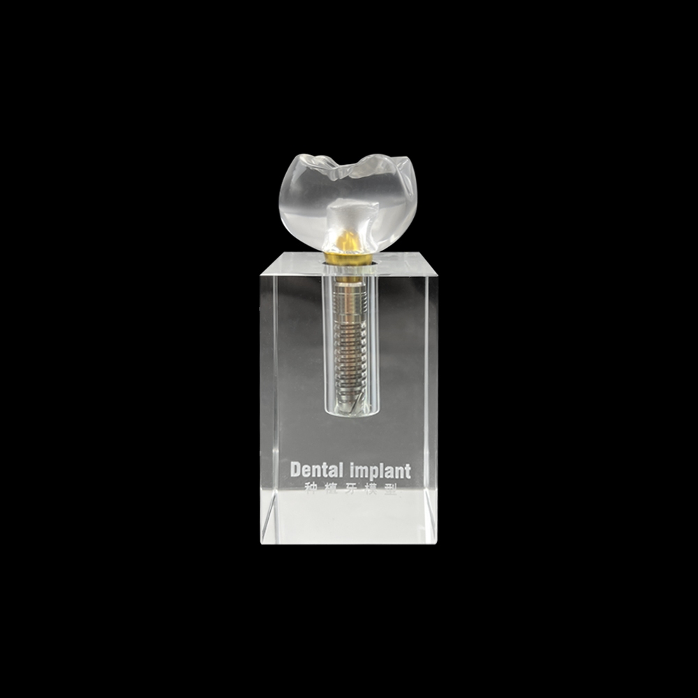 Dental Implant Teeth Model Crystal Implant Denture Model Detachable ...