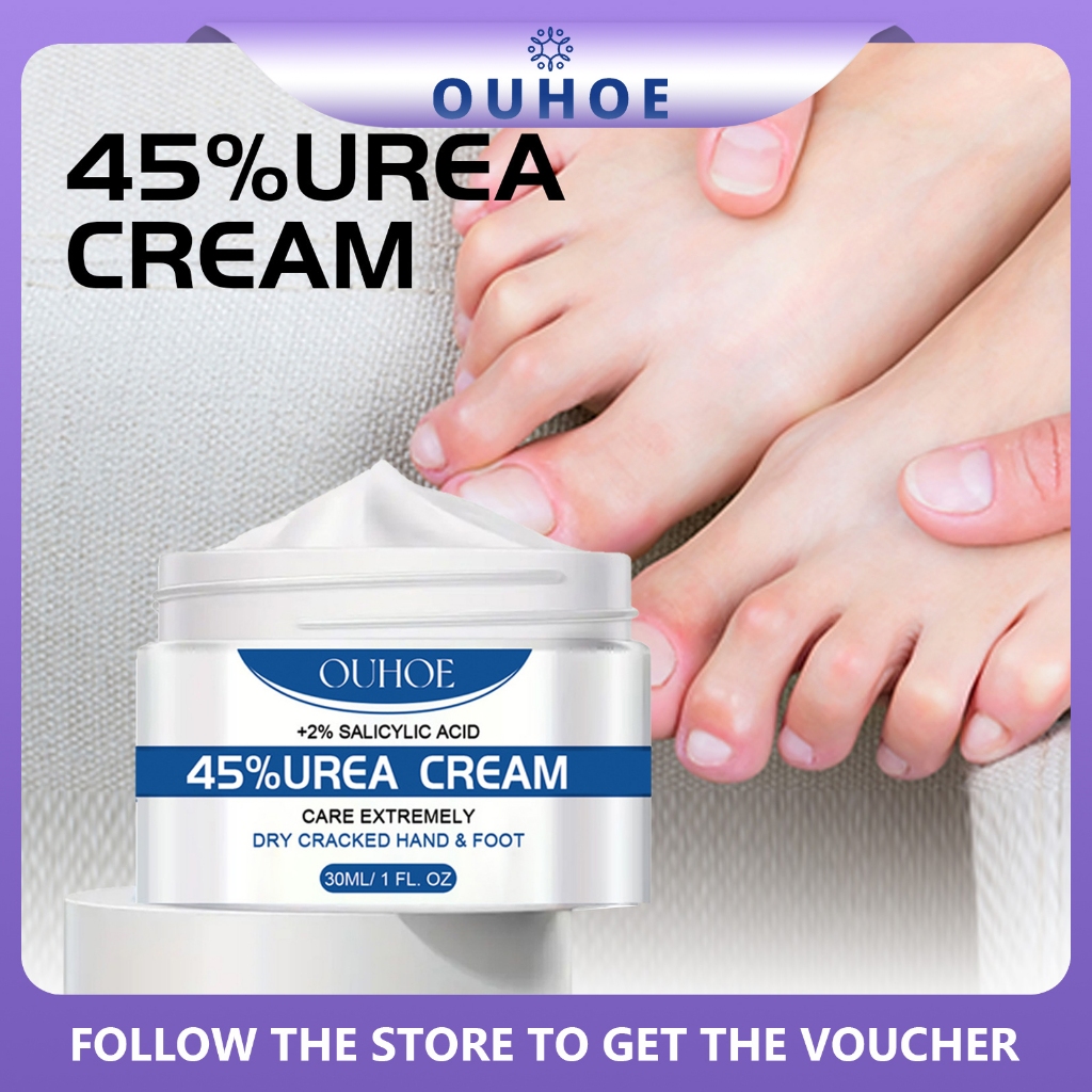 OUHOE 45%Urea Cream 30ml Care Extremely Dry Cracked Hand & Foot Lotion ...
