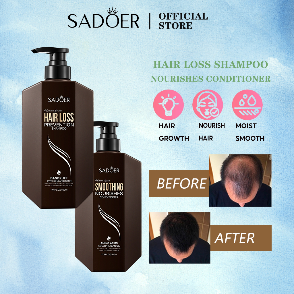 SADOER Hair Growth Shampoo Anti Hair Loss Shampo Repair Scalp Treatment Damaged Hair 500ml ...