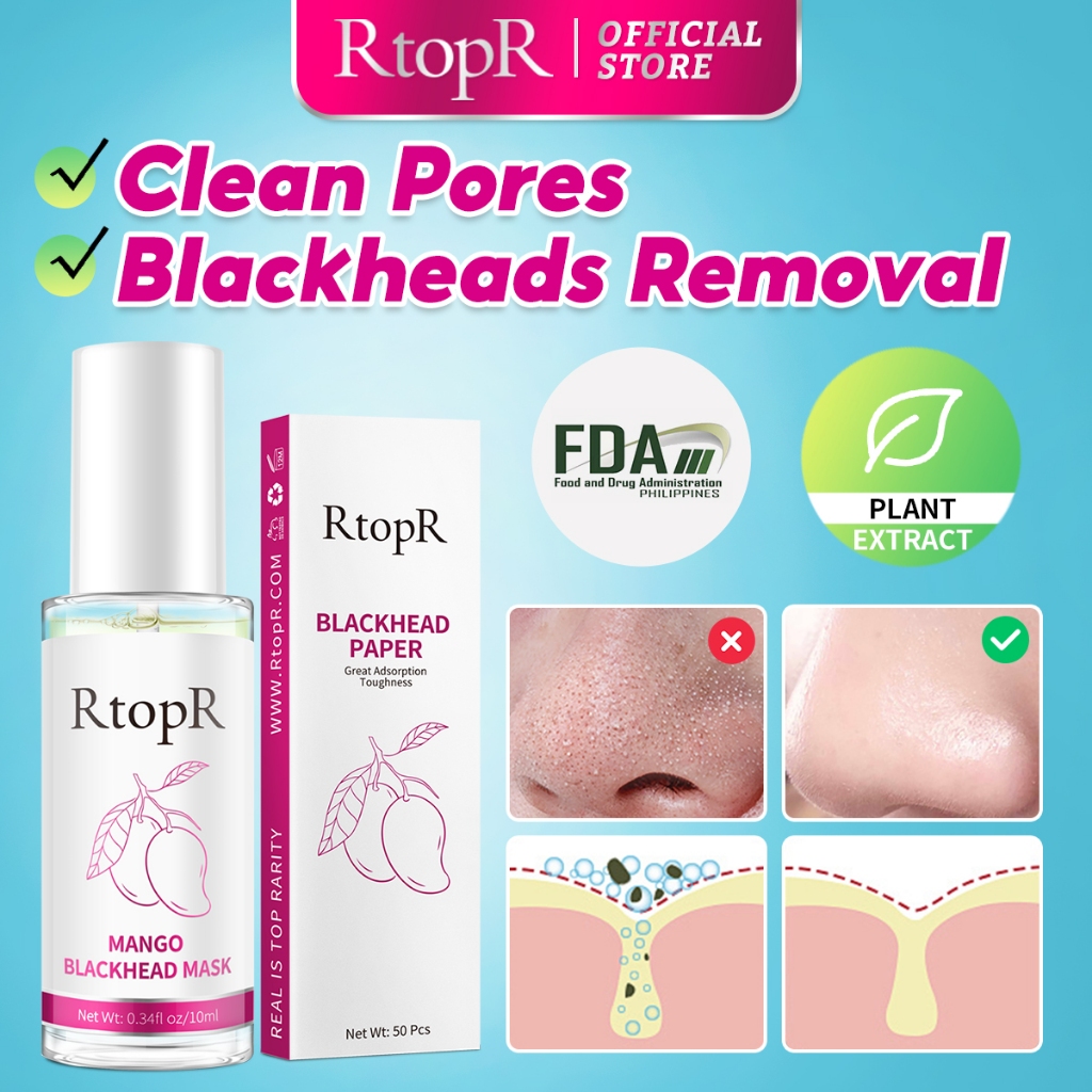 RtopR Mango Blackhead Remover Mask Deep Clean Pores Acne Treatment ...