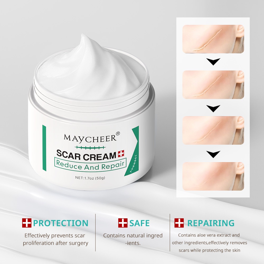 Authentic Scar Remover for Old Scar On Leg Stretch Mark Remover Remover ...