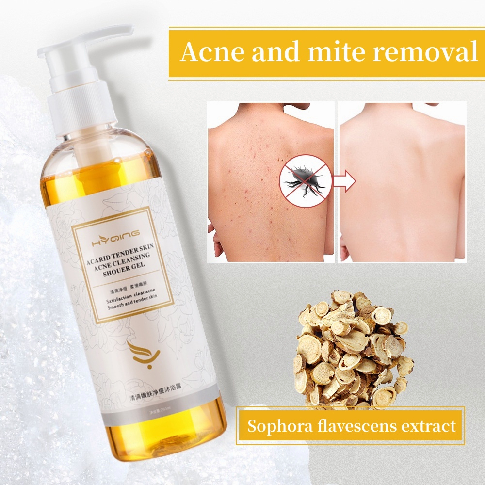 260g Eczema Treatment eczema body wash eczema lotion Skin Itching ...