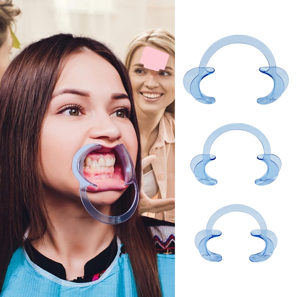 3Pcs Dental Mouth Opener C Shape Mouth Gag Dental Intraoral Cheek Lip ...