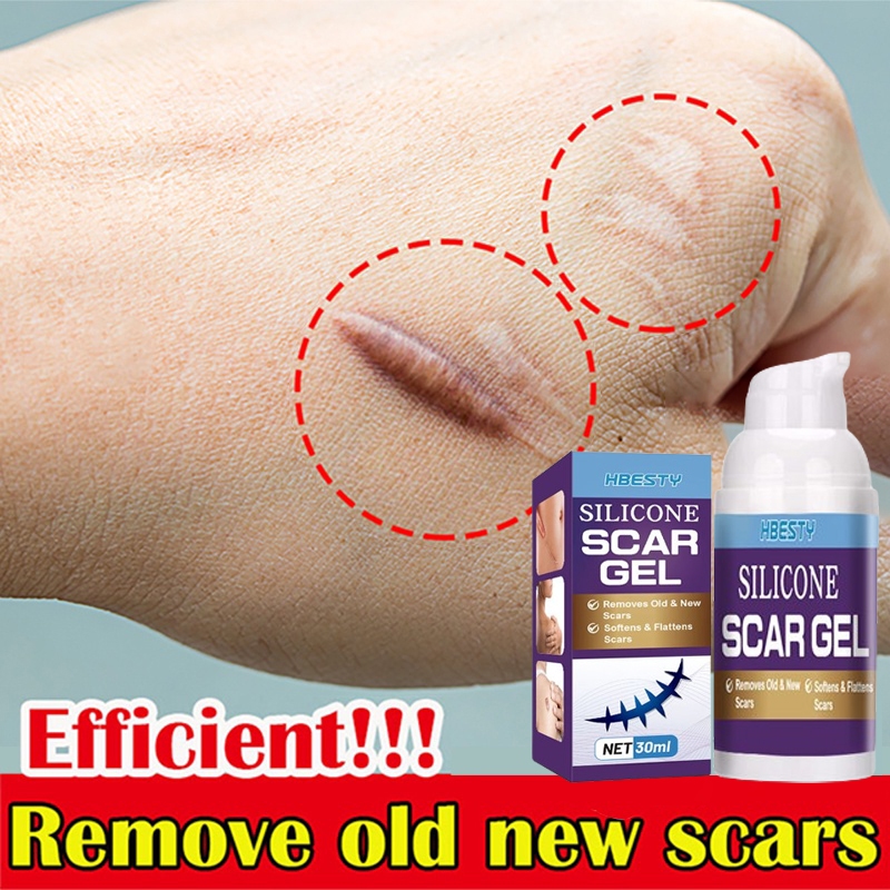 Both old and new scars can be used HB Both old and new scars can be ...