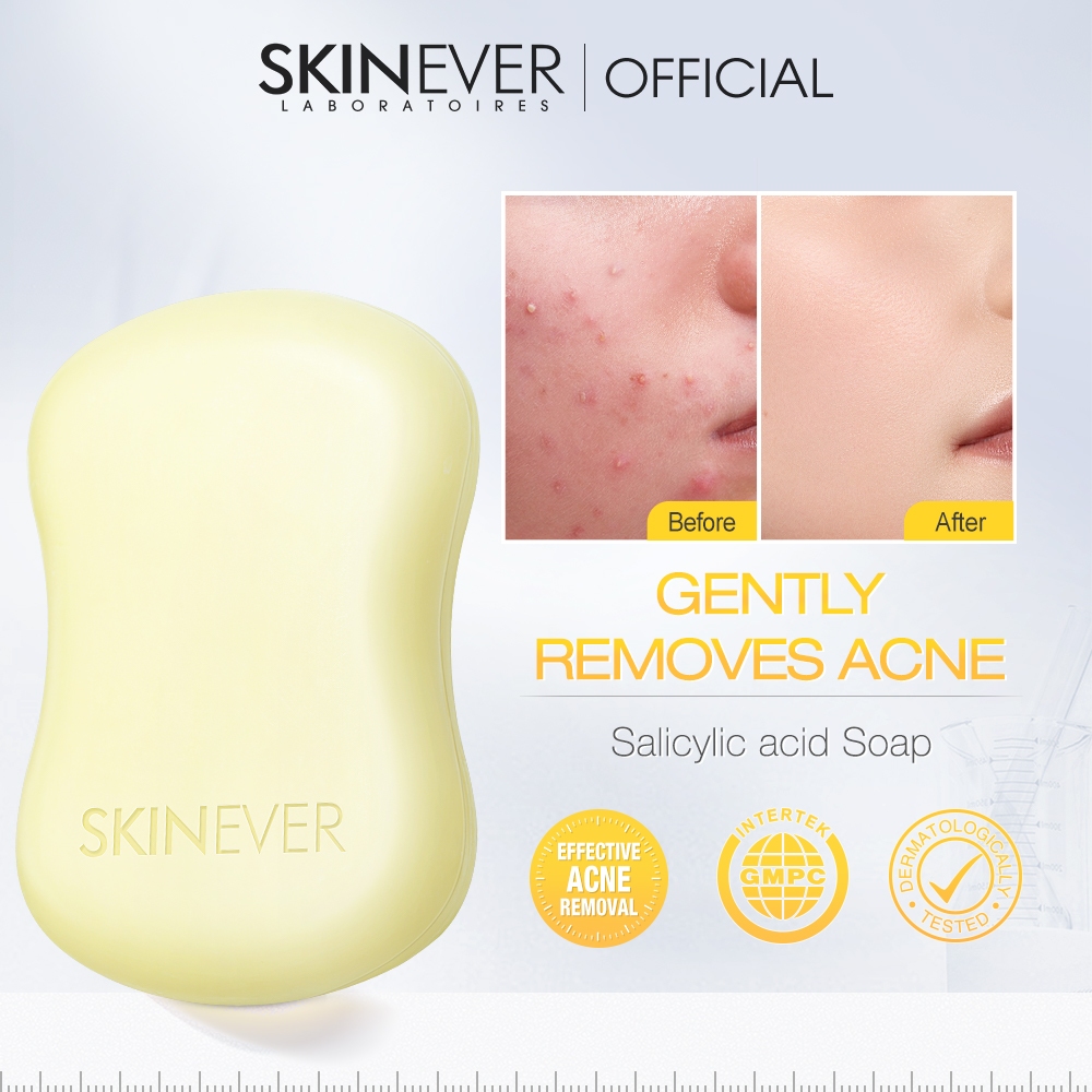 SKINEVER SALICYLIC ACID Refreshing Acne Soap Niacinamide Centella ...