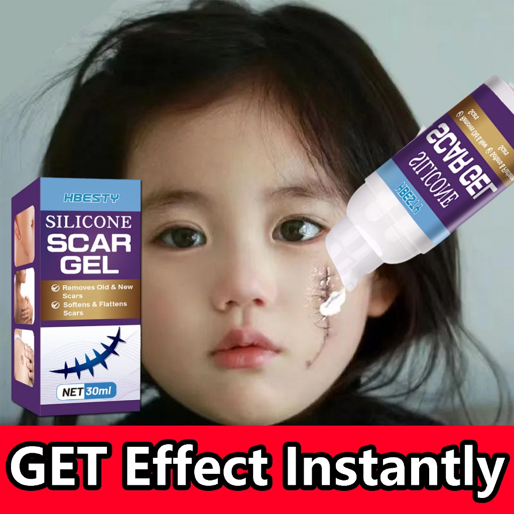 Effective on Old & New Scars DM Scar remover cream Scar remover for ...