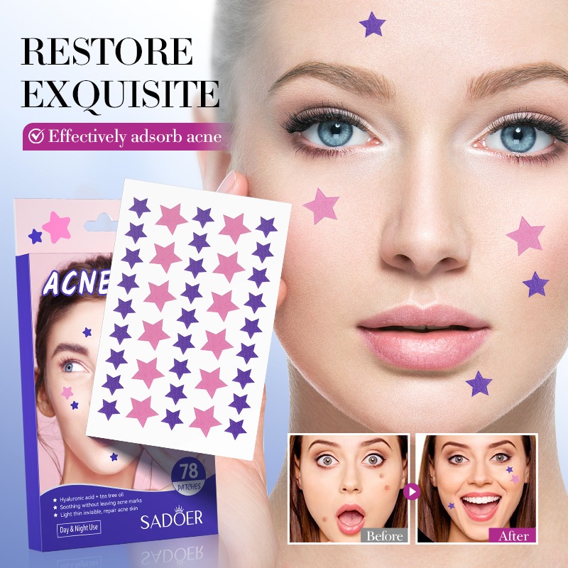 SADOER Colorful Star Acne Pimple Patch Stickers Colored Hydrocolloid ...