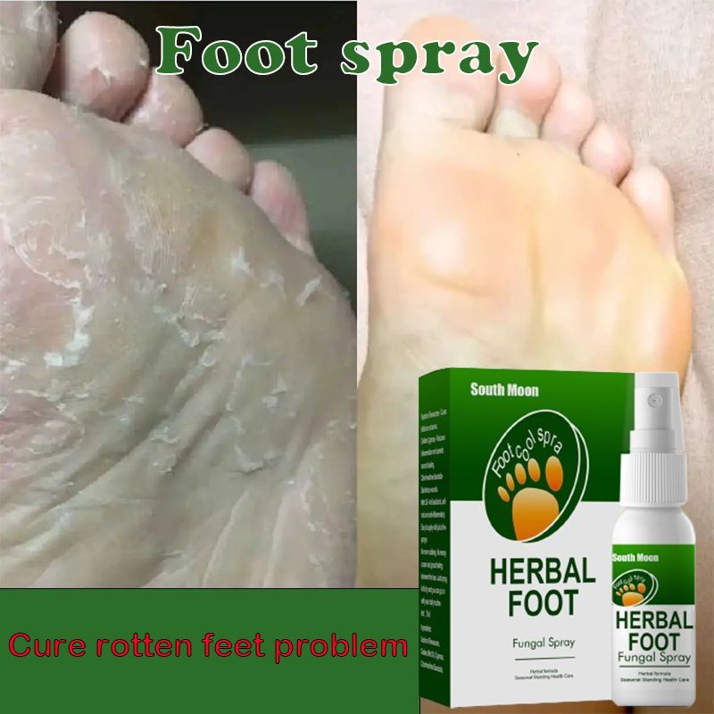 beriberi spray feet/rotten feet/blisters/erosion cure/sterilization ...