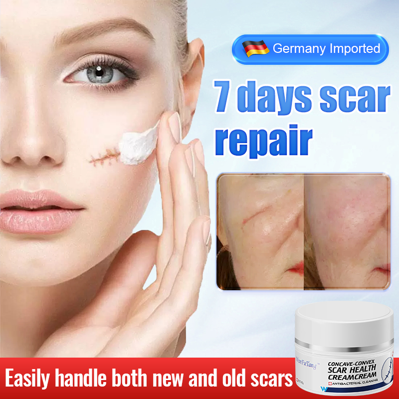 Effective Scar Remover Cream 30g Skin Care for Leg, Hand and Body ...