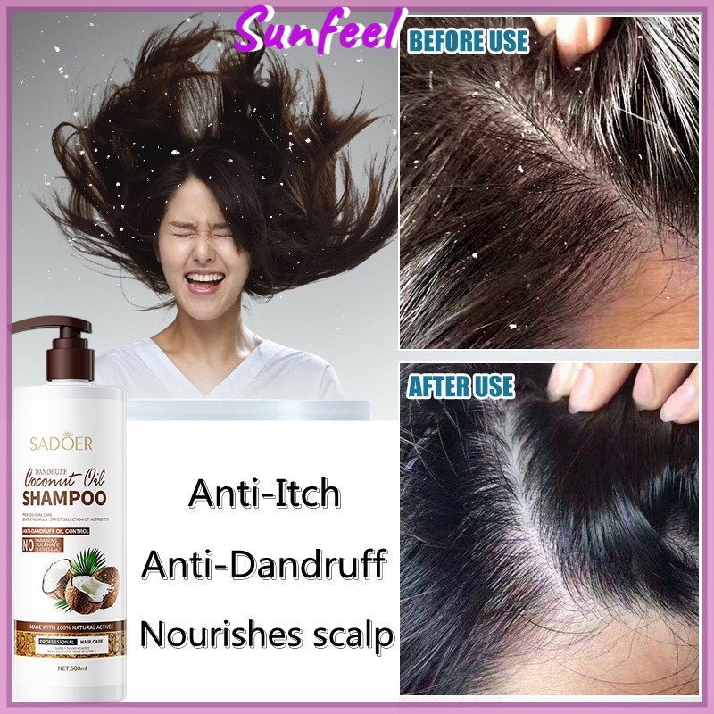 Anti Dandruff Coconut Oil Shampoo buy1take1 Refreshing Control Oil Fluffy Repair Frizz Hair ...