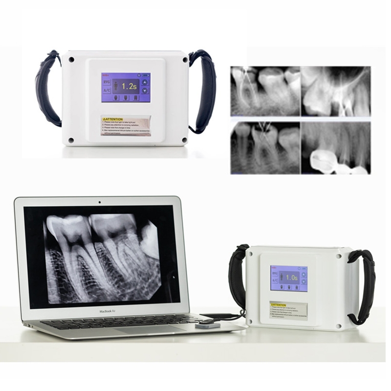 NEW Touch Screen Digital Portable Hand-held Oral Radiography X-Ray Unit ...