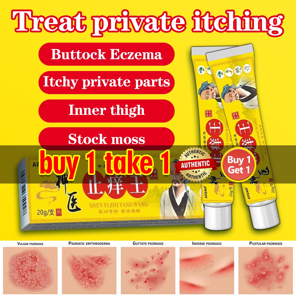 Psoriasis and Eczema Treatment Anti-fungal Ointment Cream with Atoderma ...