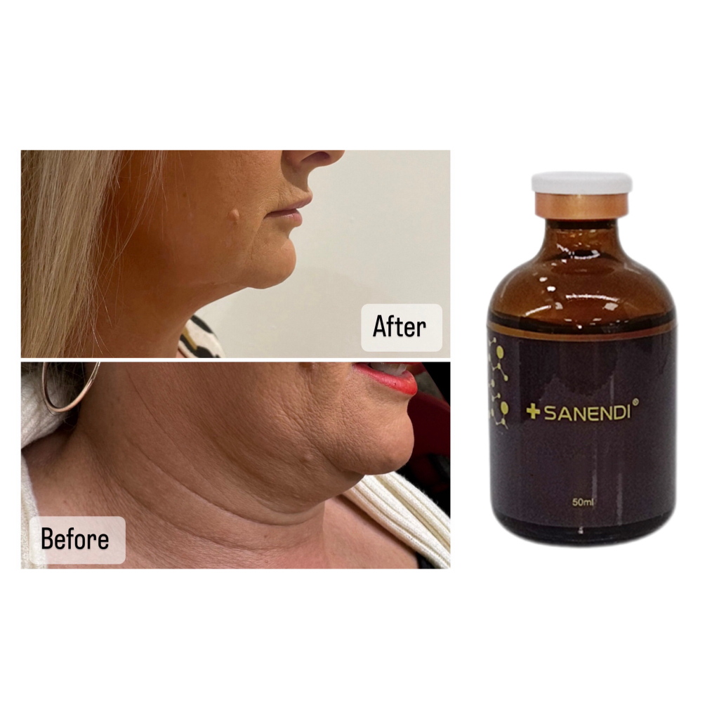Korean Original Slimming Facial Slimming Facial Serum Acceleration ...