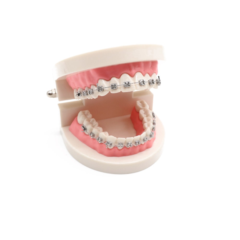 Orthodontics Metal Brackets Dental Membranes Dentists Endodontics ...