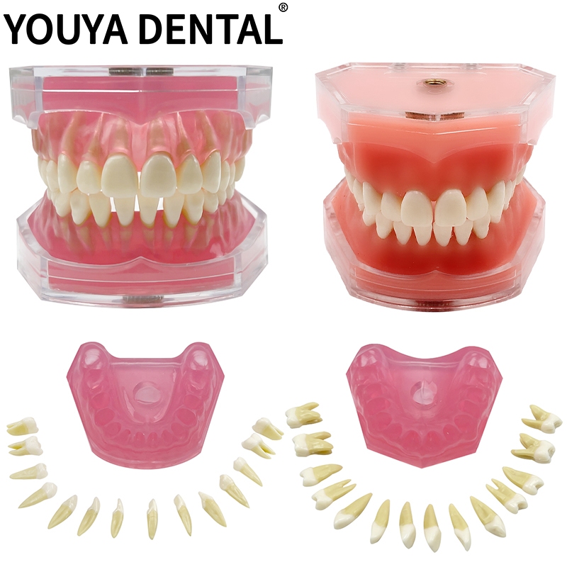 Dental Model Removable Teeth Soft Gum Teeth Model Typodont Tooth Model ...