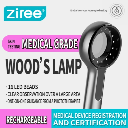 Woods Lamp Skin Analyzer Portable LED Wood Light Examination UV Black ...