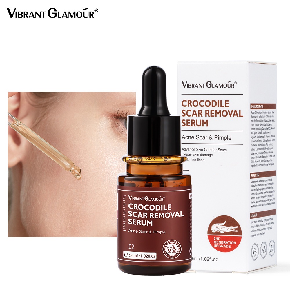 VIBRANT GLAMOUR Crocodile Scar Repair Serum Acne Treatment Stretch ...