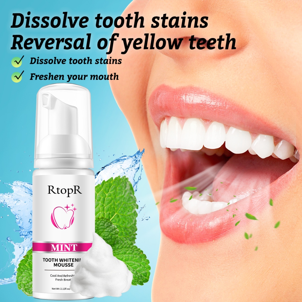 RtopR Teeth Cleansing Whitening Mousse Removes Stains Oral Hygiene ...
