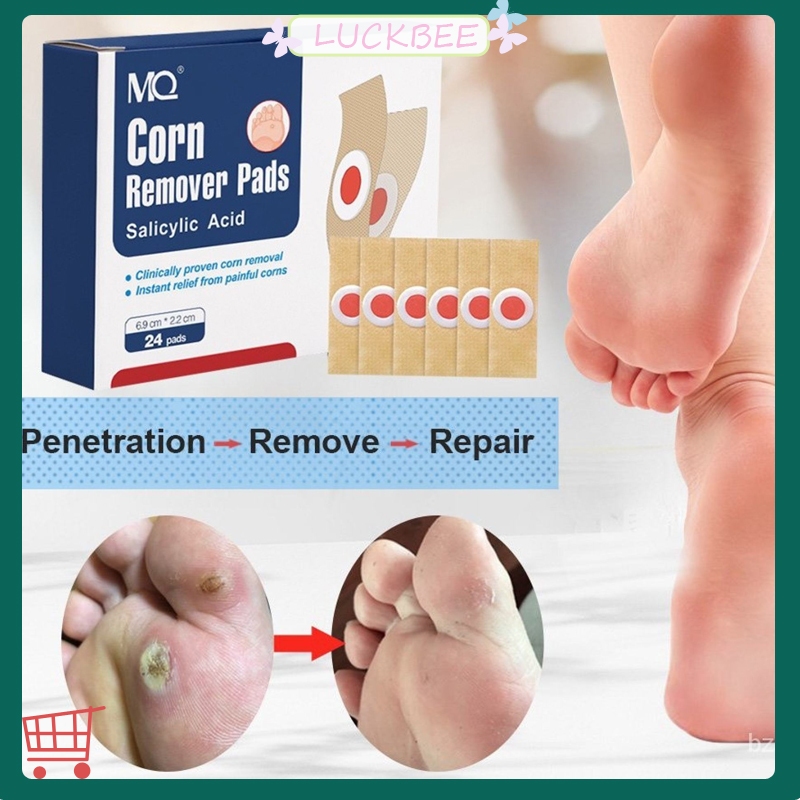 Corns Warts Removal Foot Corns 24Pcs Warts Removal Patch Pain Relief ...
