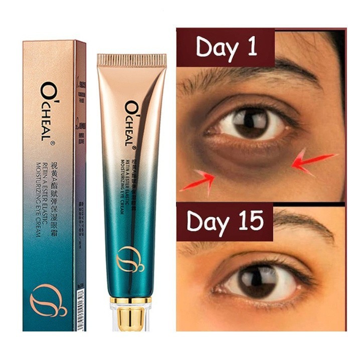Eye Cream for Dark Circles and Puffiness Anti Aging Reduce Fine Lines ...