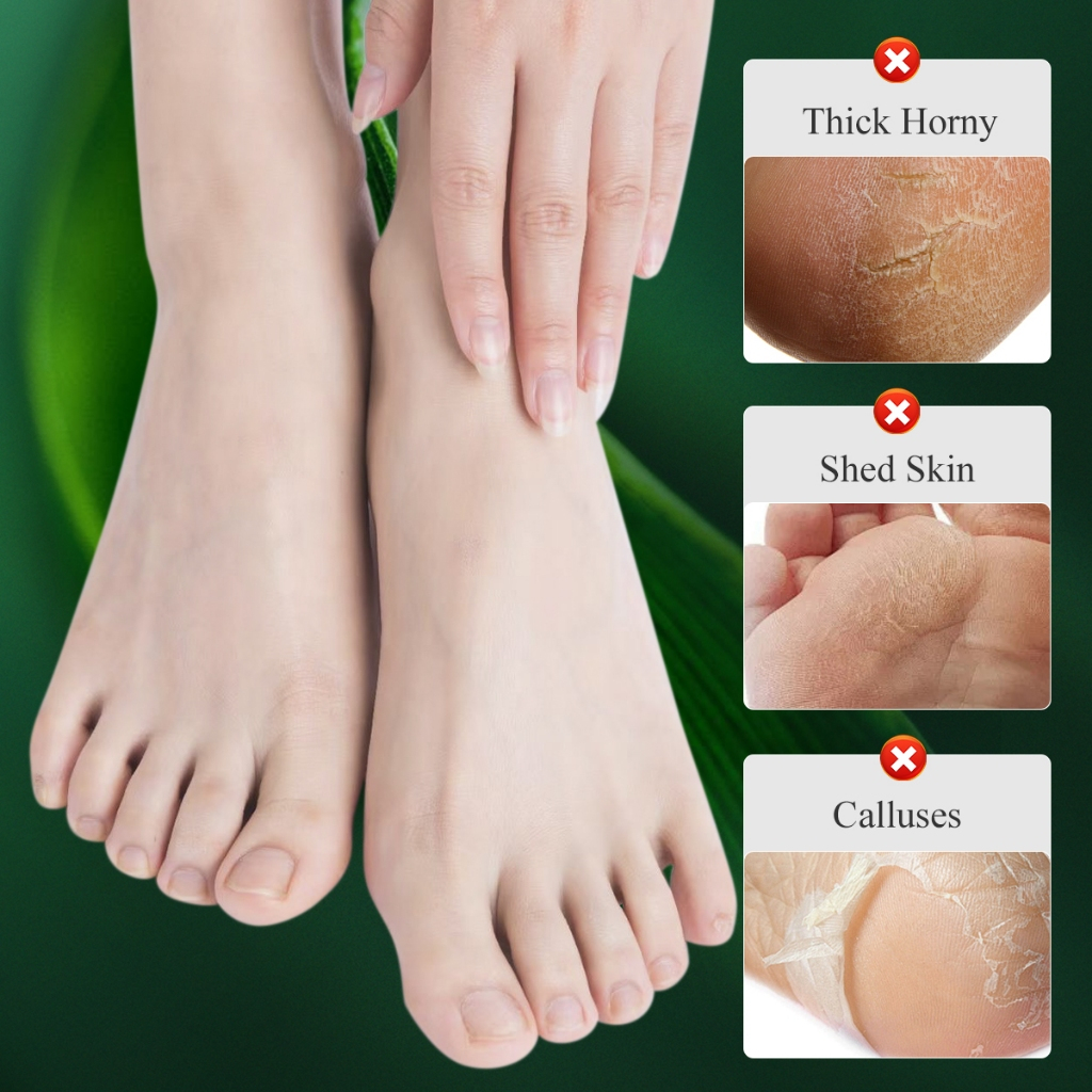 MABREM Foot Treatment Cream Anti Cracking Moisturizing Foot Care Anti ...