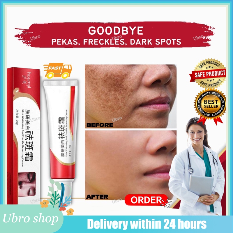 Melasma Cream 20G Pekas Remover Effective Anti Freckle Collagen ...