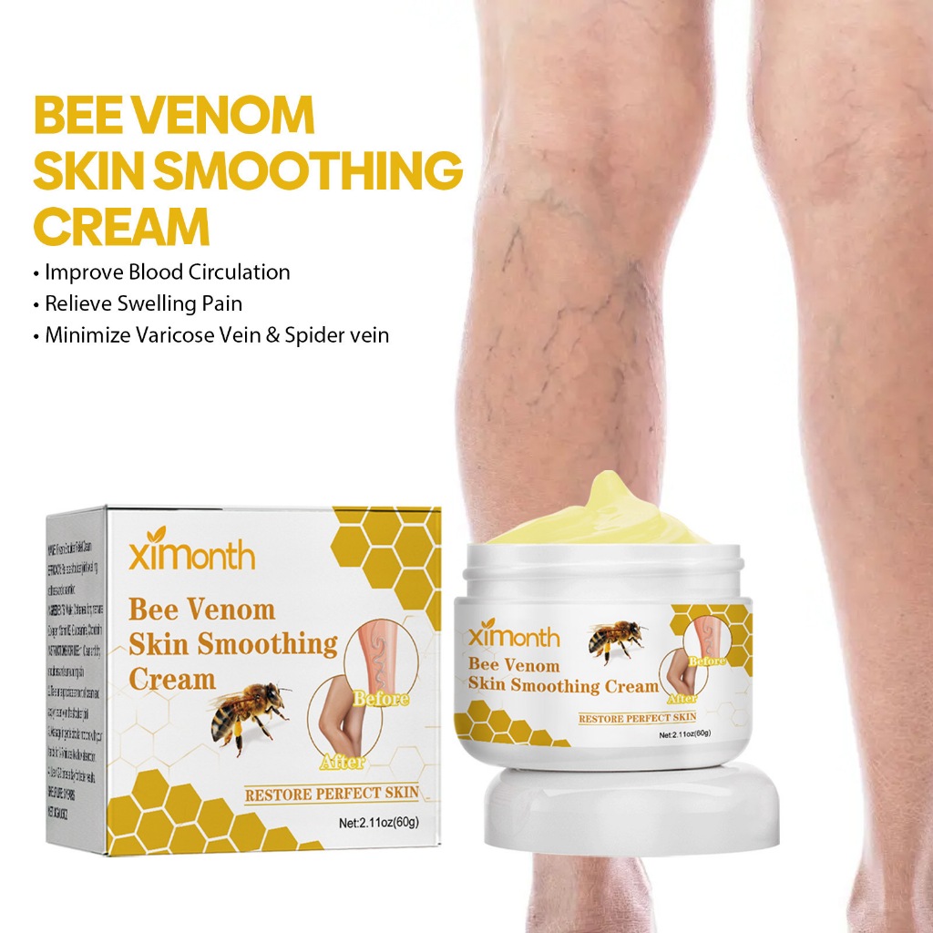 Venoheal Varicose Veins Ease Pain Paste, PasteSpider Veins, Cream for ...