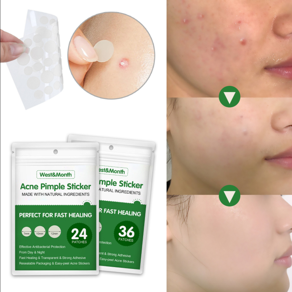 360 pcs Acne Pimple Sticker Invisible Concealer Acne Patch Acne Patches ...