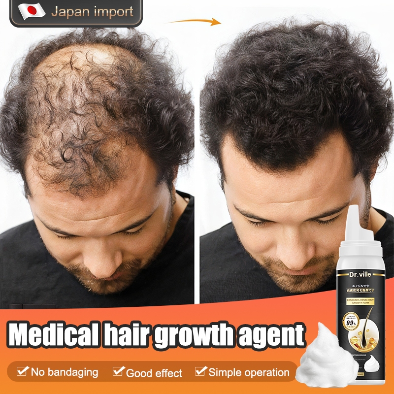 Dr.Ville Minoxidil Hair Grower Foam Mousse Hair Grower for Man Hair ...