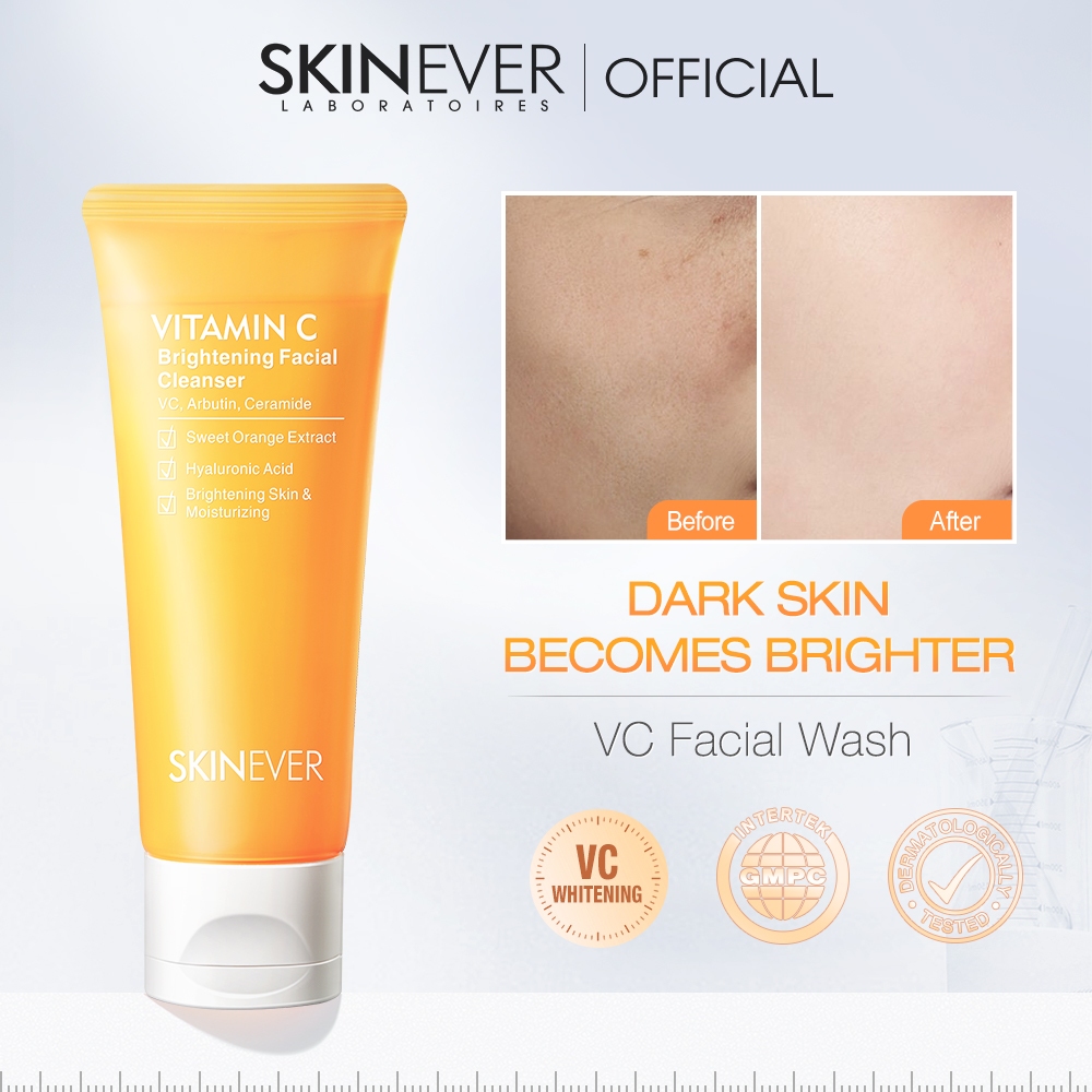 SKINEVER Vitamin C Whitening Facial Cleanser Gentle Cleansing Skincare ...