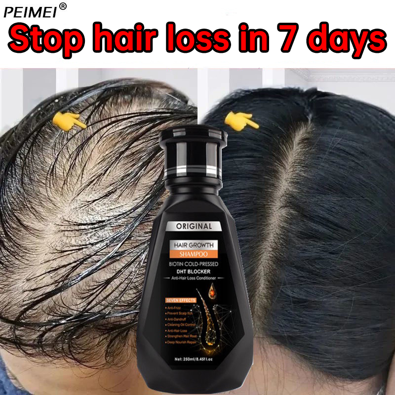 Hair Growth Ginger shampoo, Anti hair loss shampoo, Prevent hair loss ...