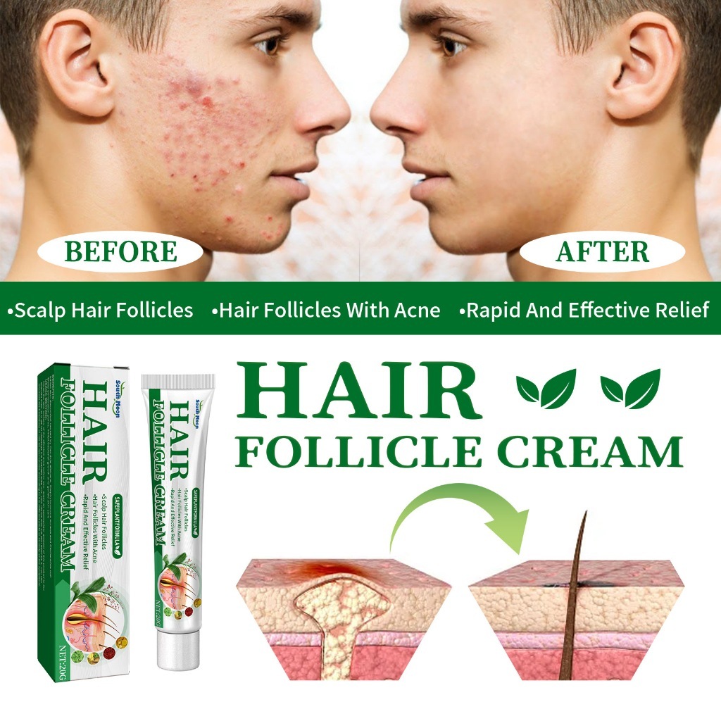 In stock & 20g Hair Follicle Cream Folliculitis Cream Skin Care Natural ...
