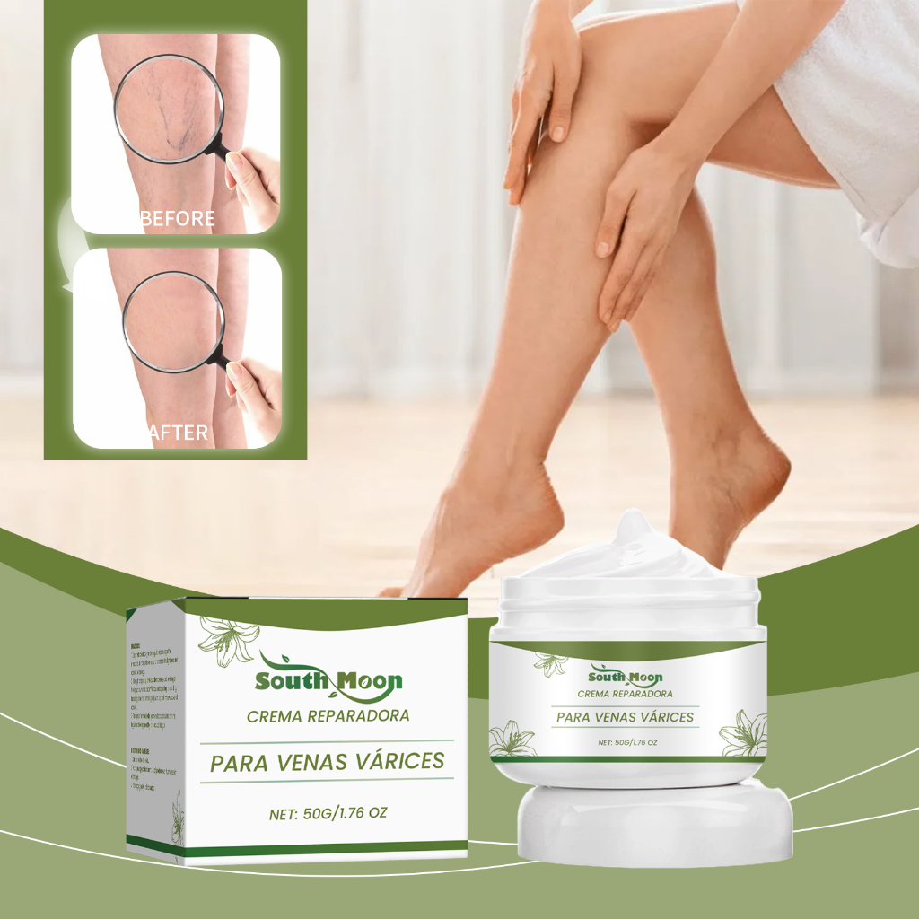 South Moon Varicose Vein Repair Cream Vasculitis Phlebitis Treatment ...