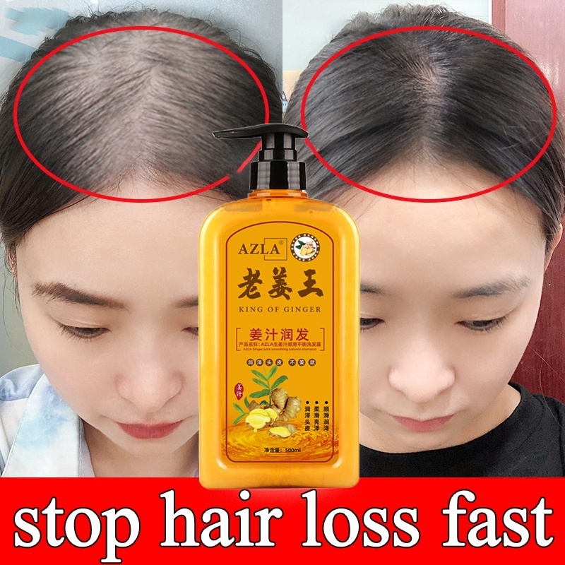 AZLA Ginger Hair Shampoo Fast Regrowth Hair Thick Anti-Hair Loss Anti ...