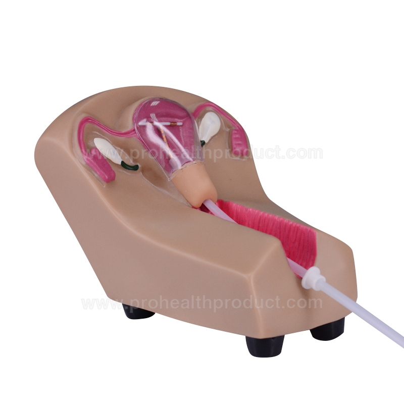 Uterine Contraception Model, IUD Training Simulator for IUD Insertion ...
