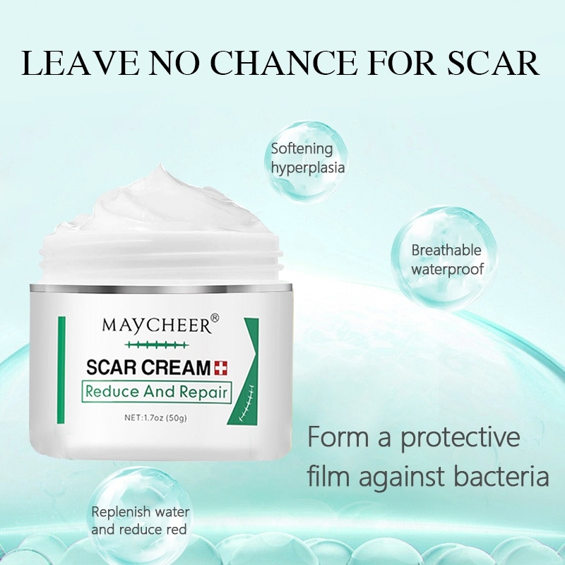 Scar Remover for Old Scar On Leg Stretch Mark Remover Scar Gel Fix Scar ...