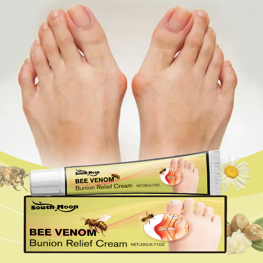 Gout Treatment Ointment Hallux Valgus Bunion Toe Swelling Pain Relief ...