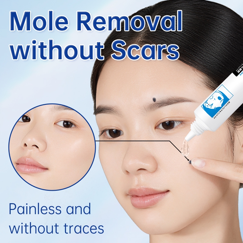 30g Warts Remover Original Cream Painless Wart Remover Ointment ...