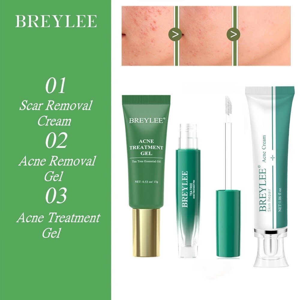 BREYLEE Acne Gel Scar Cream, Tea Tree Oil Acne Scar Removal Facial Care | Shopee Philippines