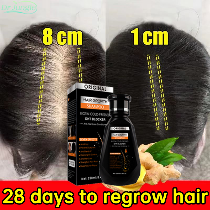Ginger Shampoo for Hair Loss Herbal Ginger Extract Shampoo Hair Grower ...