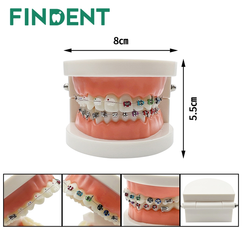 1Pcs 1/4 Self-Locking Dental Orthodontic Treatment Teeth Model With ...