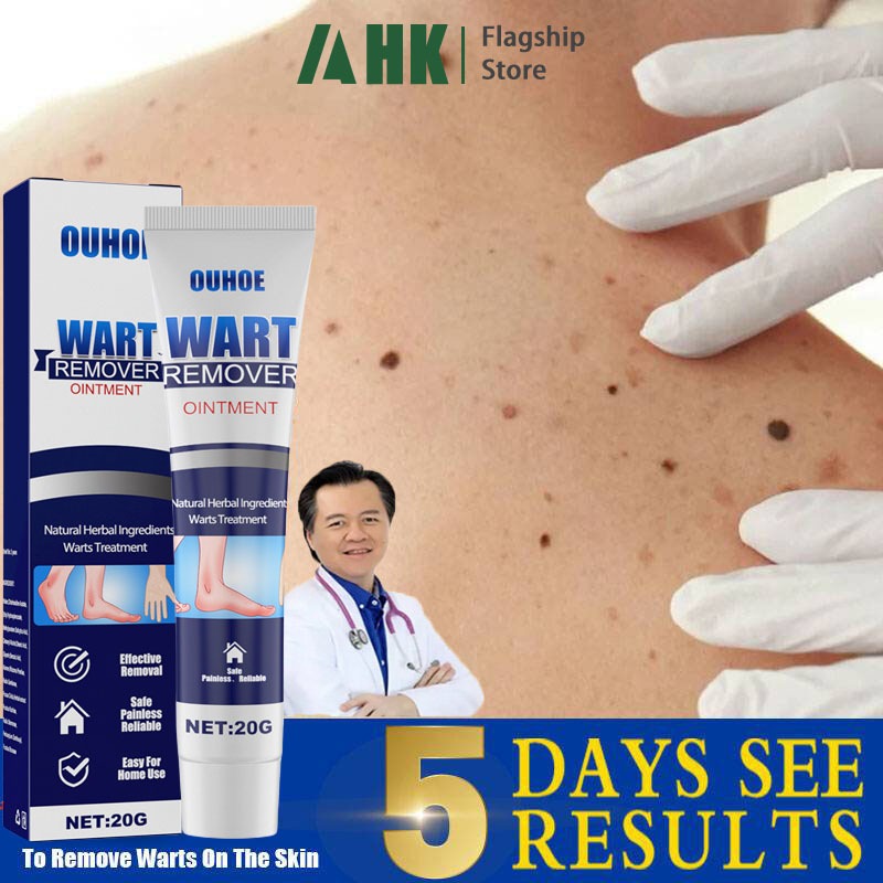 Wart Removal Cream Painless wart remover cream Mole remover Warts ...