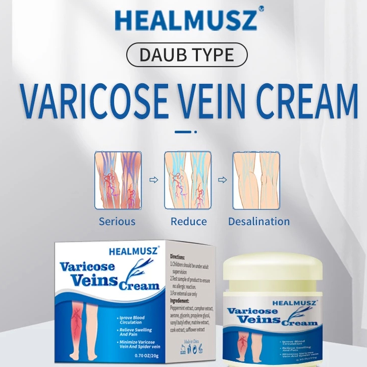 Varicose Vein Cream Patch Spray Remover Spider Vein Pain Killer Cream ...