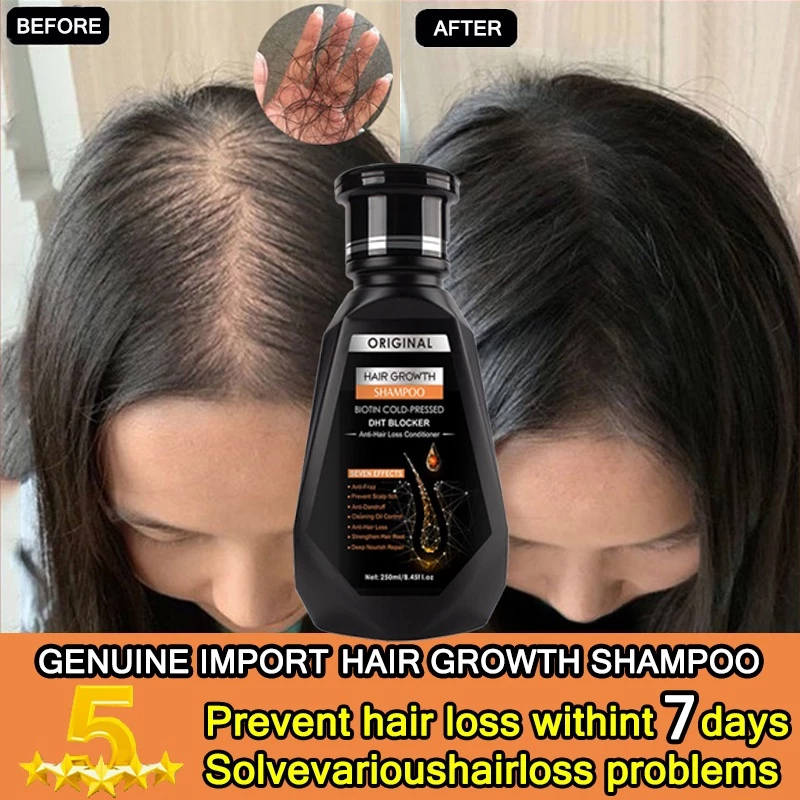 7 Day Fast Hair Growth Hair Thickener And Ginger Shampoo Original Hair ...