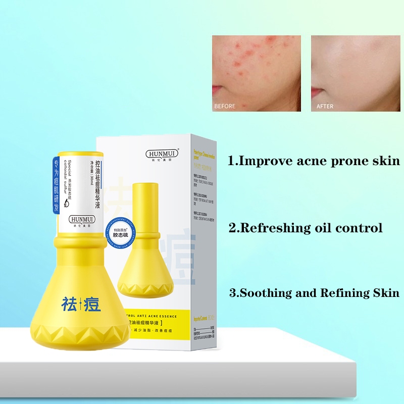 Acne Remover Essence Serum Acne Treatment Acne Pimple Marks Oil Control ...