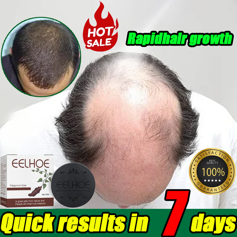【Authentic】 Hair Growth Soap: Promotes thick hair, nourishes the scalp ...