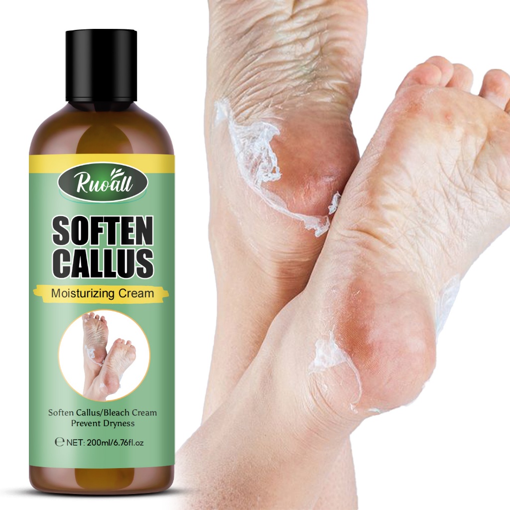 Ruoall Heel Dry Callus Remover 200ml / Foot Moisturizer / Anti-Cracking ...
