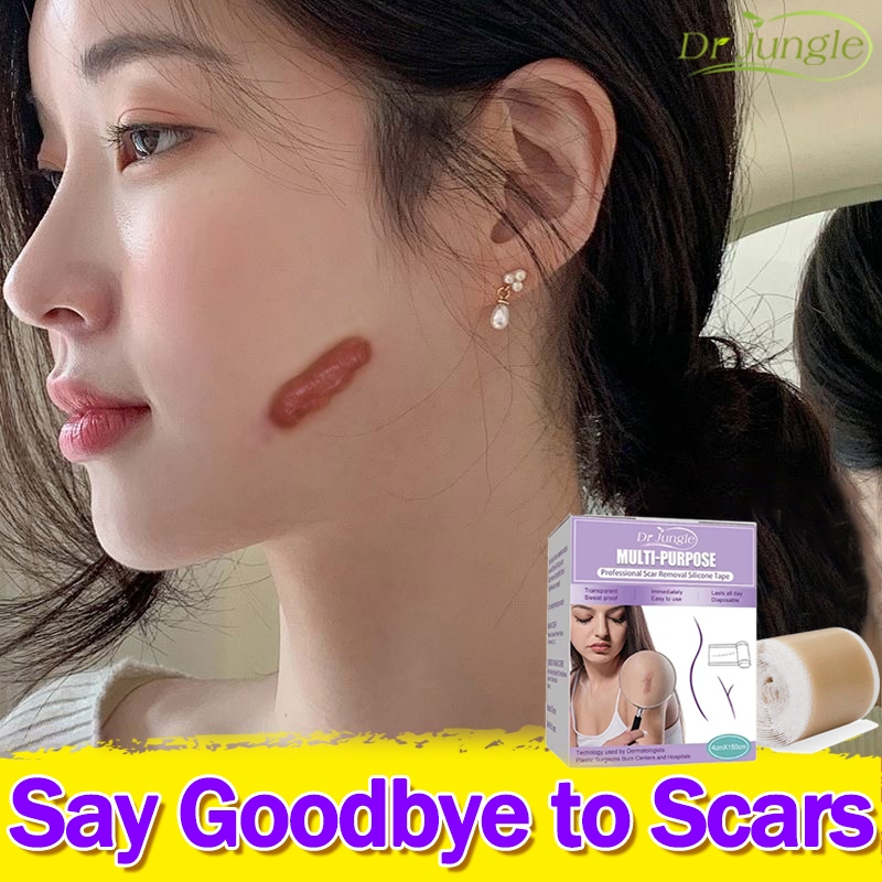 【Authentic】Dr Scar Patch Scar Removal Patch: Effective treatment of ...