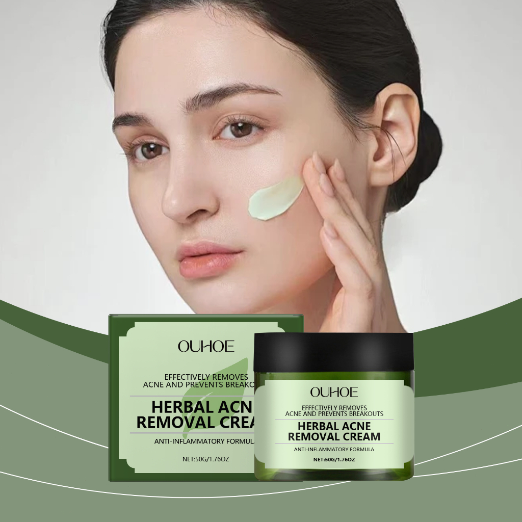 Herbal Anti Acne Cream Face Remove Pimple Soothing Redness Oil Control Moisturizing Facial Acne ...